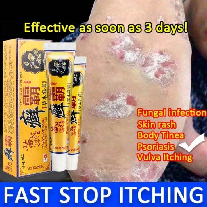 【cod】 Sumifun Psoriasis Eczema Treatment Cream Herbal Antibacterial
