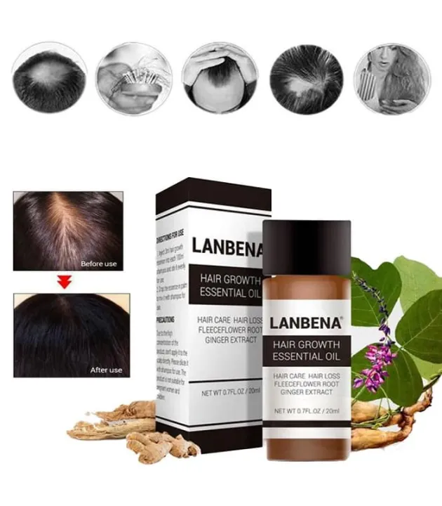 Lanbena Hair Growth Essence Essential Oil Liquid Treatment Preventing