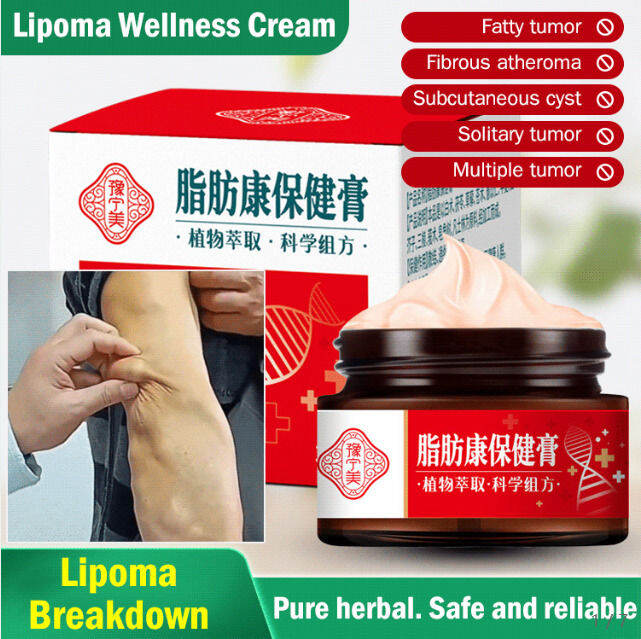 onlcicn Whole Body Herbal Health Cream Fat lump nodule care ointment ...