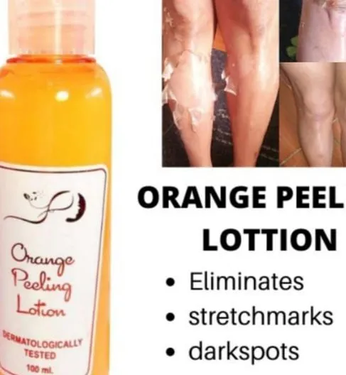 Original Orange Peeling Lotion INSTANT WHITENING IN JUST 5 DAYS ...