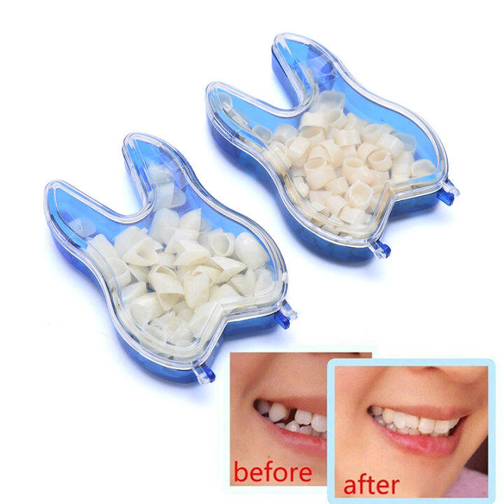 Temporary Resin Dental Crowns Simulation Porcelain Teeth Oral Teeth ...