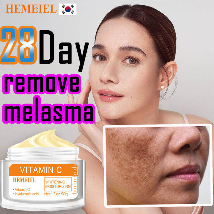 HEMEIEL Melasma Cream/Dark Spots Remover/Olee White Clean Melasma ...