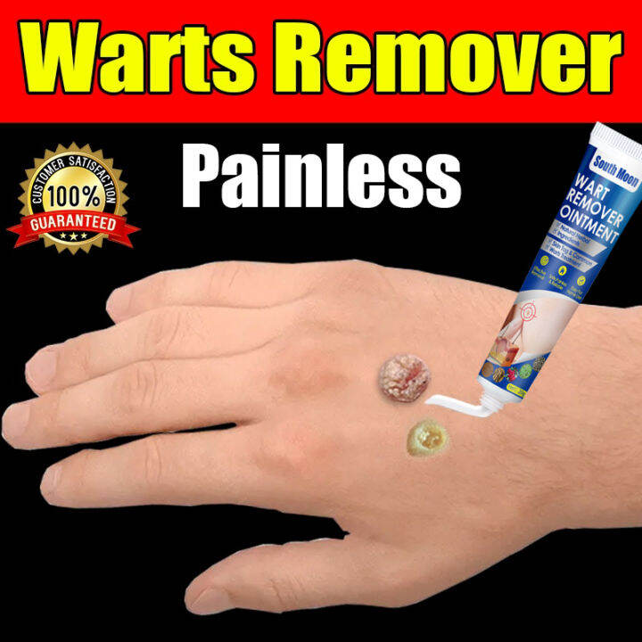 Warts Remover Original Cream Warts Magic Remover Wart Ointment Original ...