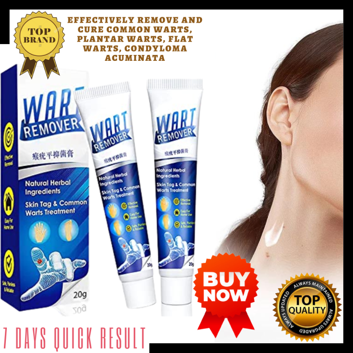 Warts Remover Antibacterial Ointment Warts Magic Remover Skin Growth ...