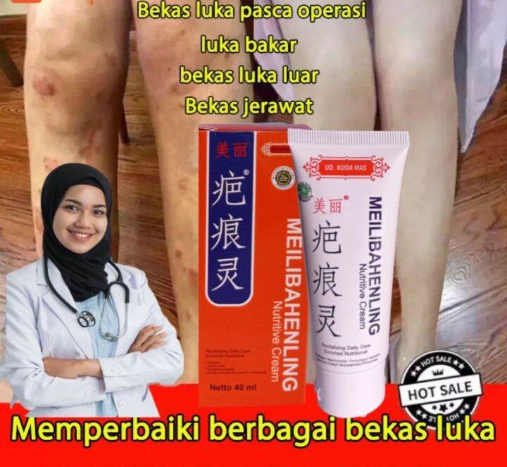 meilibahenling asli penghilang bekas luka bisul borok budug cacar air ...