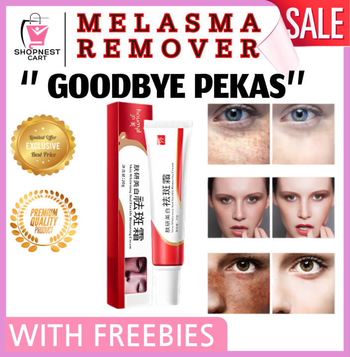 SHOPNEST CART Melasma cream pekas remover Melasma cream super collagen ...