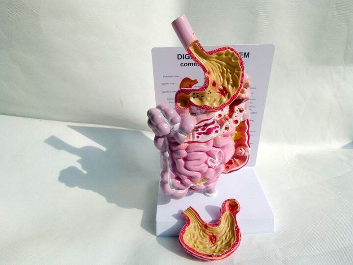 12 Life Size Human Digestive System Anatomical Model Colorectal ...