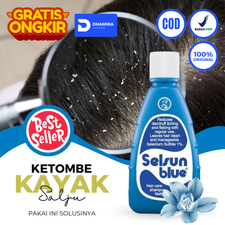 Selsun Blue Shampoo Anti Ketombe - Sampo Anti Ketombe Dan Gatal Perawatan Rambut Obat Ketombe ...