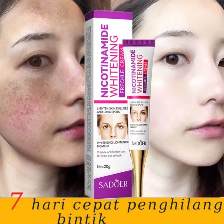 Melasma Cream Whitening Freckle Cream Japanese Melasma Cream Original ...
