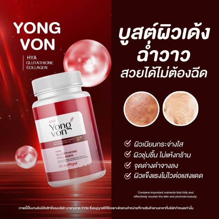 Yong Von ยองวอน ยังวอน กลูต้ายองวอน วิตามินเกาหลี กลูต้าเกาหลี กลูต้า