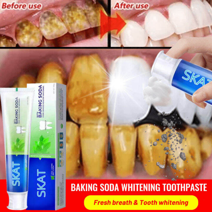 SKAT Baking Soda Teeth Whitening Toothpaste Whitening Peppermint Food ...