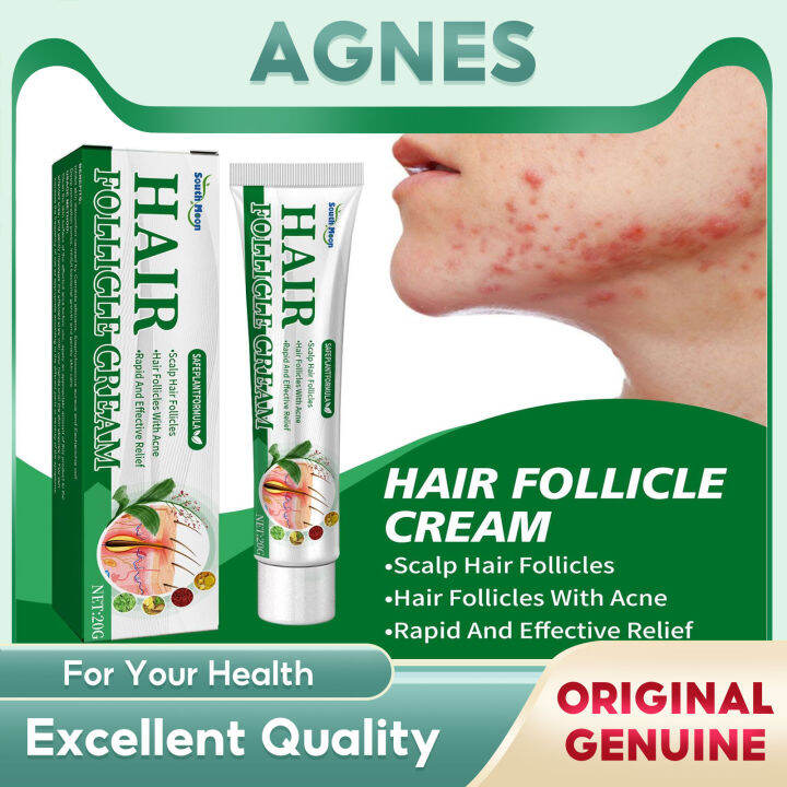 South Moon Skin Care Hair Follicle Cream Keratine Hair Follicles Acne ...