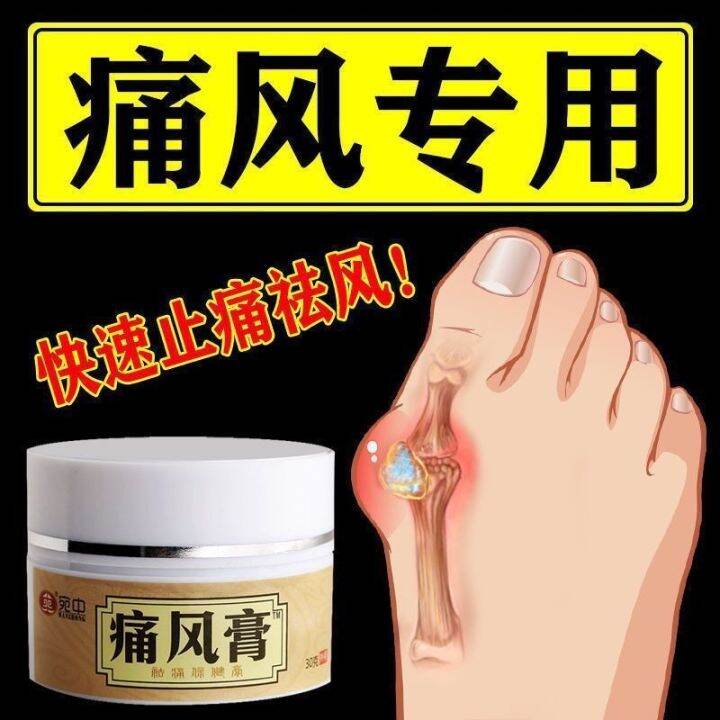 Gout Ointment Special Effect Joint Pain Big Toe Finger Red Hot Swelling ...