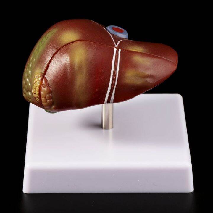 props model Human Liver Pathological Anatomical Model Anatomy School ...