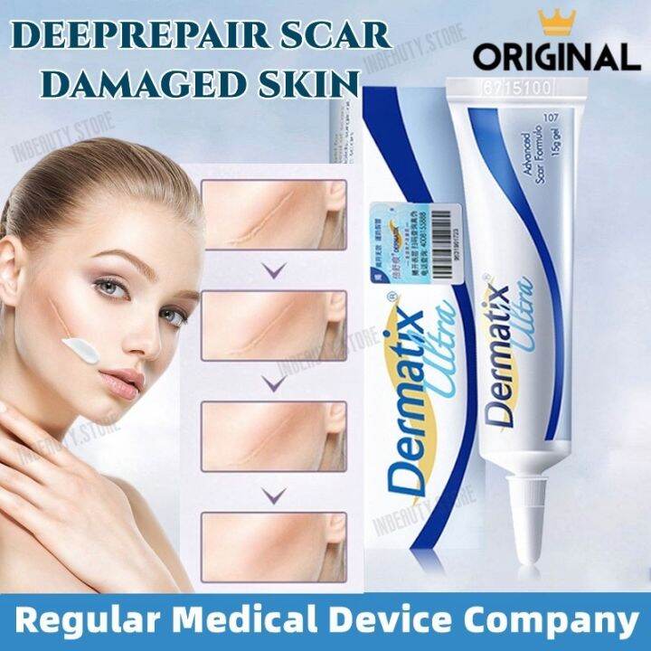 Dermatix Effective Scar Removal Cream Scar Gel Old Scars Acne Scar ...