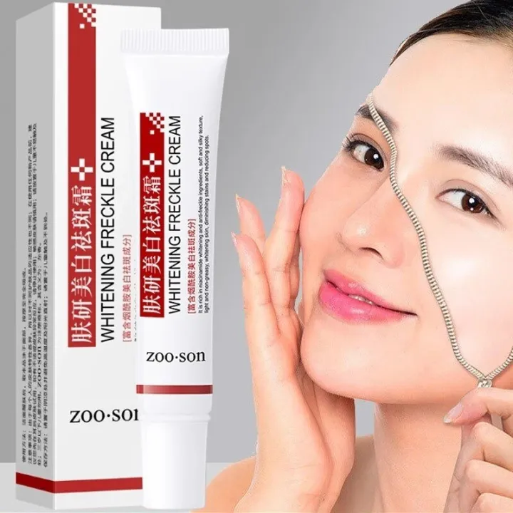 Effective Whitening Freckle Cream Remove Dark Spots Anti Freckle Cream Fade Pigmentation Melasma ...