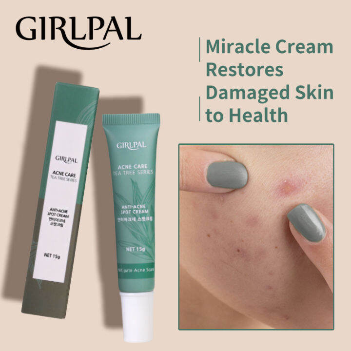 [BPOM] GIRLPAL Anti Acne Spot Cream 15g Tea Tree Treatment Acnes Cream ...