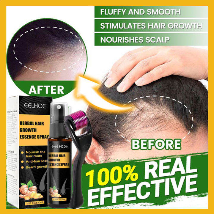 Hair Grower For Men Original Hair Spray Minoxidil Hair Grower Original