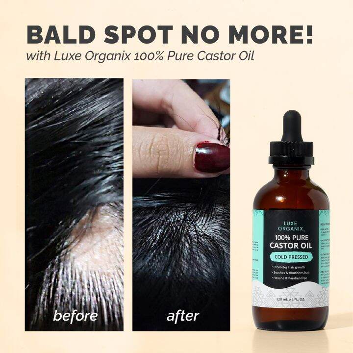 CASTOR OIL DROPS Luxe organix 100% Pure 120 ml | Lazada PH