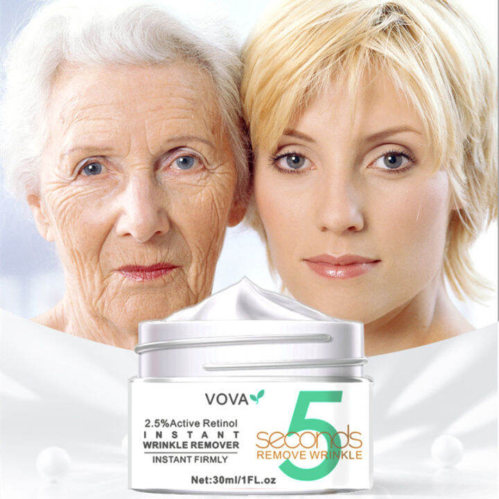 Active Retinol Face Cream 5 Seconds Instant Wrinkles Removal Cream ...