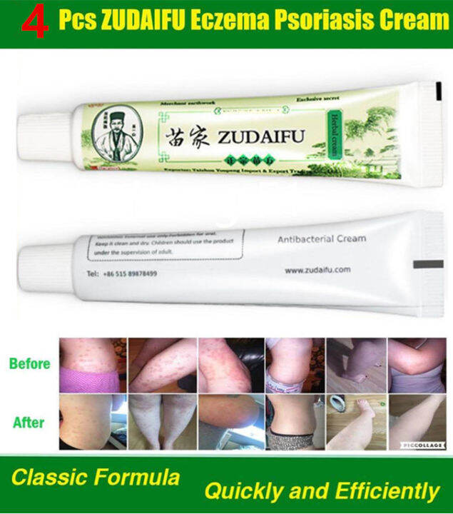 Open 24 Hours Set Of 4 Natural Chinese Herbal Medicine Cream Eczema