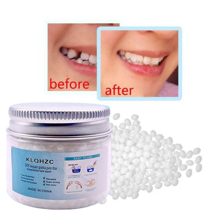 DIY Tooth Repair Kit Temporary 50g Denture Care Modified tooth gum ...