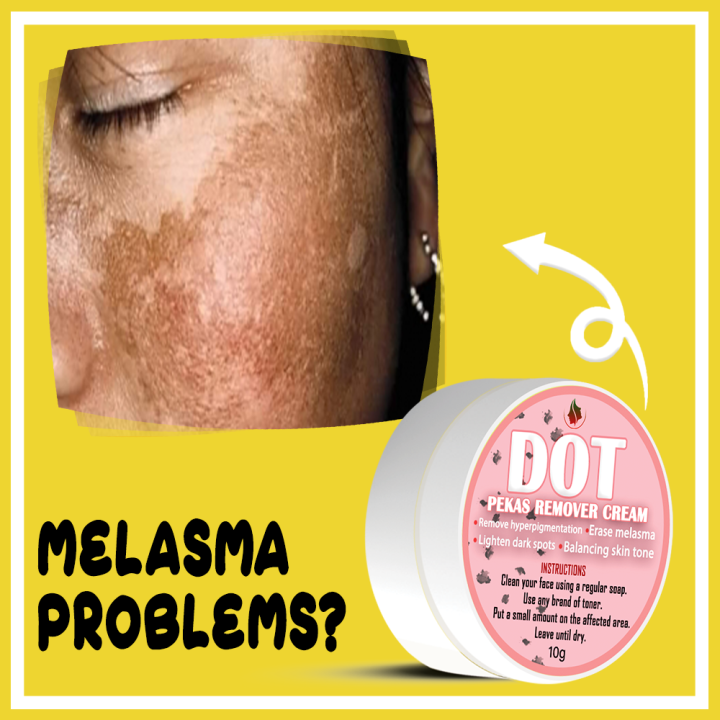 DERMA TESTED DOT PEKAS CREAM Pekas Remover Cream , melasma cream ...