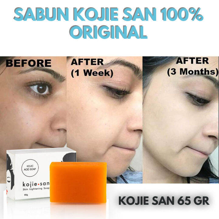 Sabun Kojie San 65gr / Kojisan / Koeji San / Sabun Pencerah Wajah Soap ...
