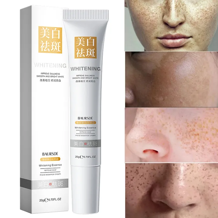 Dark Spot Corrector Cream Whitening Freckle Cream Powerful Removing Melasma Melanin Dark Spots ...