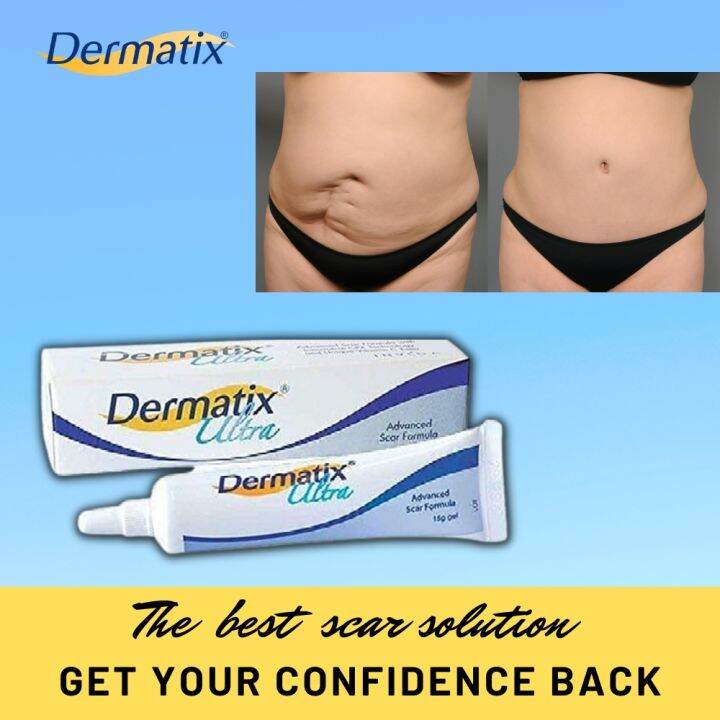 Advance Formula Dermatrix Ultragel Original Scar Remover Old Acne Surgical Scar Australian BEST ...