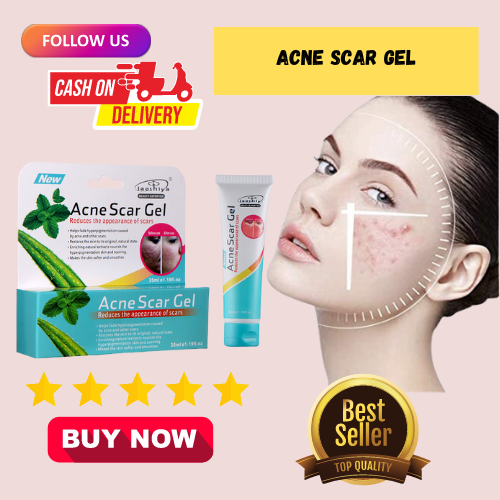 Acne Scar Gel with Aloe Vera | Lazada PH