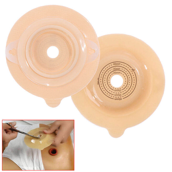 Convex Bottom Plate for Two Piece Colostomy Pouch Ostomy 45mm | Lazada PH