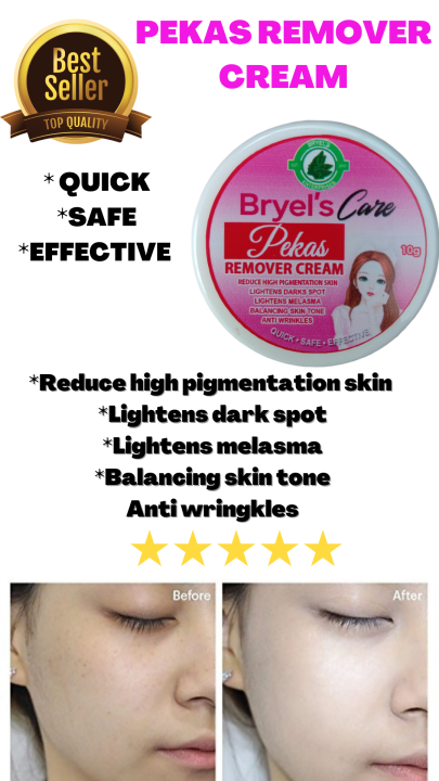 PEKAS CREAM REMOVER CREAM 10G Effective freckle removal whitening cream ...