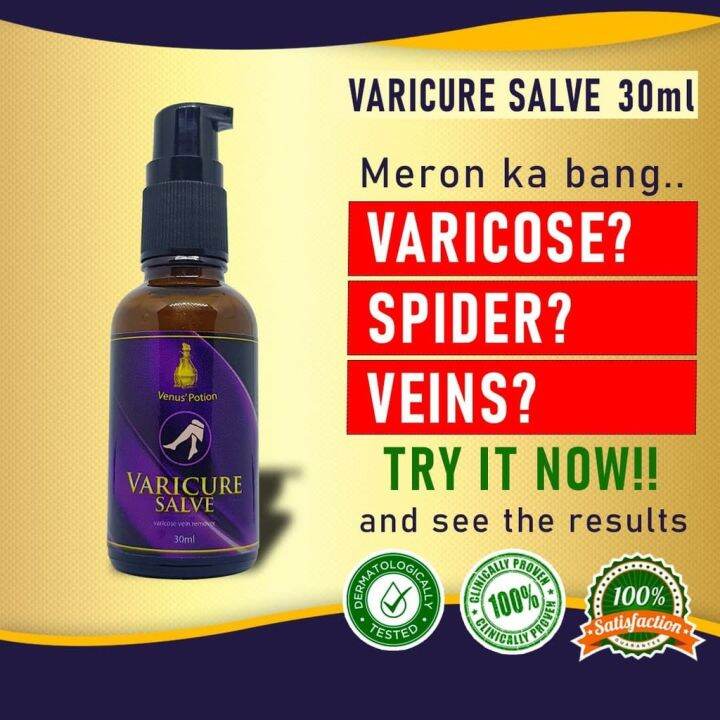 Venus Potion Varicose Vein Remover 30 mL - Varicose Veins and Spider ...