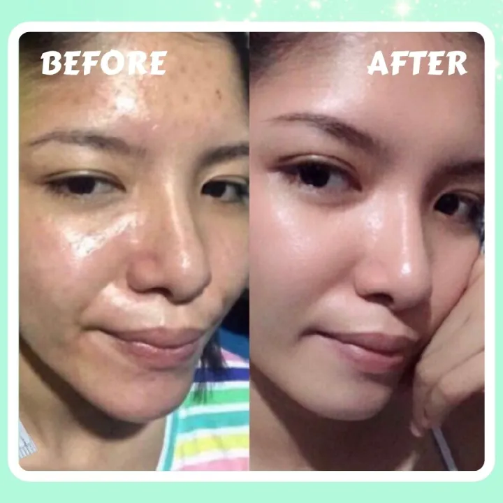 Clarity Facial Set | Rejuvenating Set | Big Set | Clarity Essentials ...