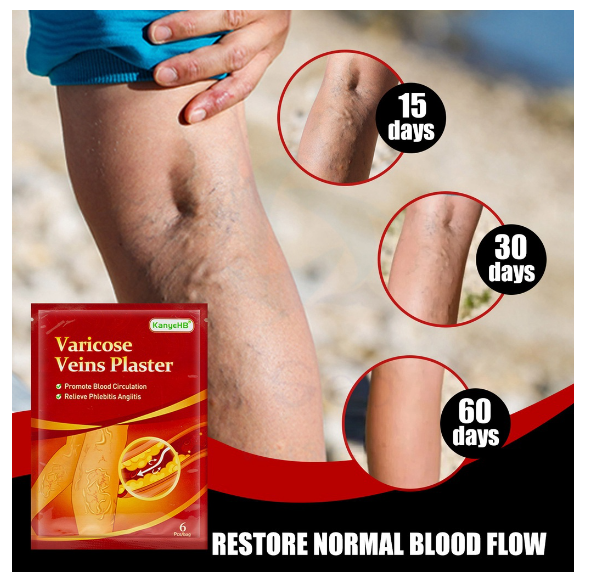 Varicose Veins Plaster Patch Pain Relief Relievers Knee Patches Muscle ...