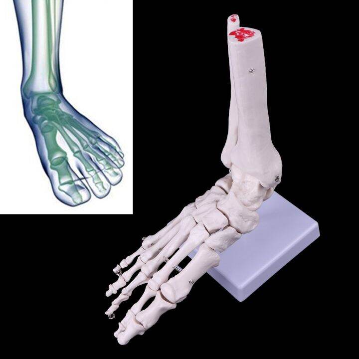 * Life size Foot Ankle Joint Anatomical Skeleton Model Medical Study ...