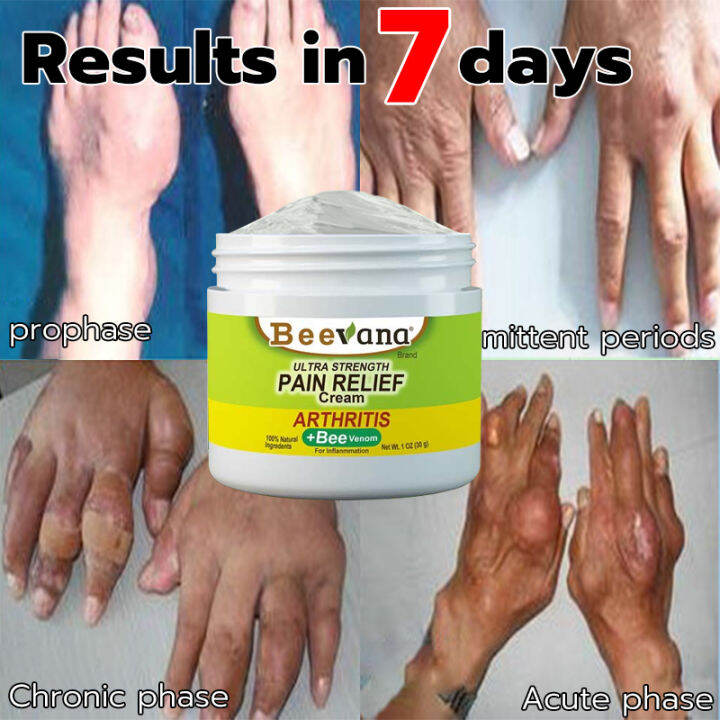 Beevana BeeVenom Joint & Bone Therapy Cream Natural Joint Relief Joint ...