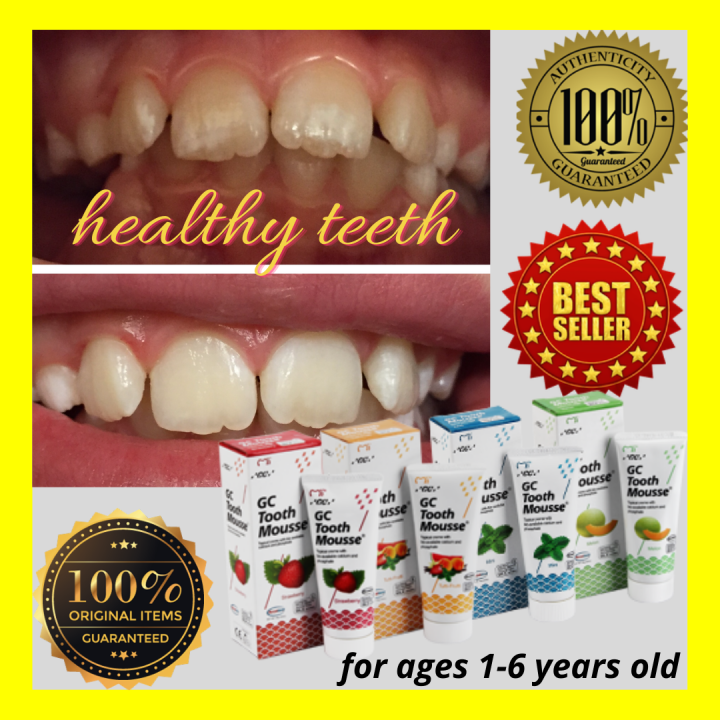 GC TOOTH MOUSSE|ANTI CAVITY| TODDLERS| RECALDENT |DRYMOUTH|WHITE SPOTS ...