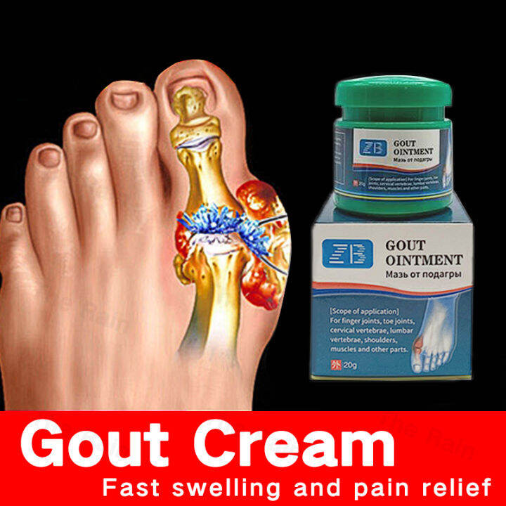 Gout Ointment Gout Ointment Cream for Arthritis Treatment Hand Foot ...