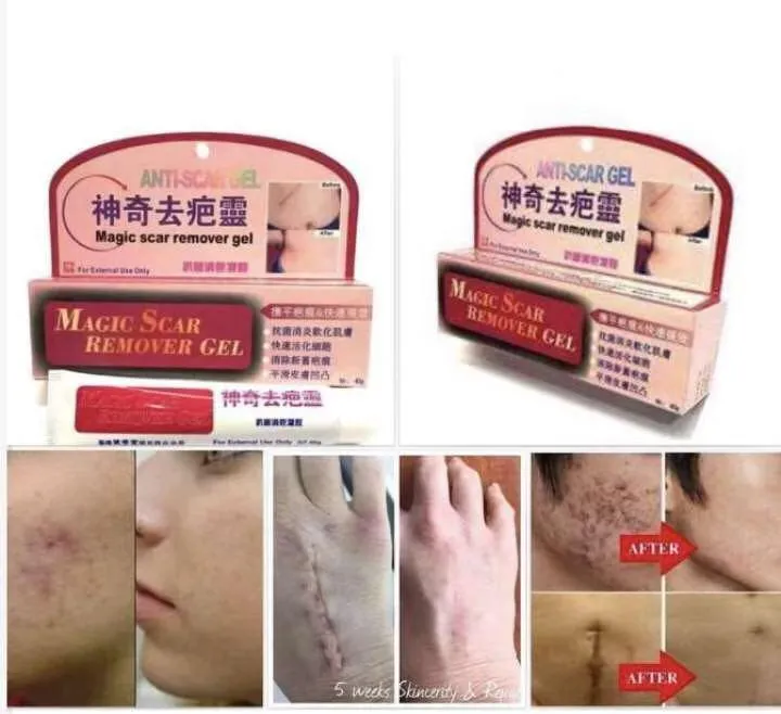 Magic Scar Remover Gel 40g | Lazada PH
