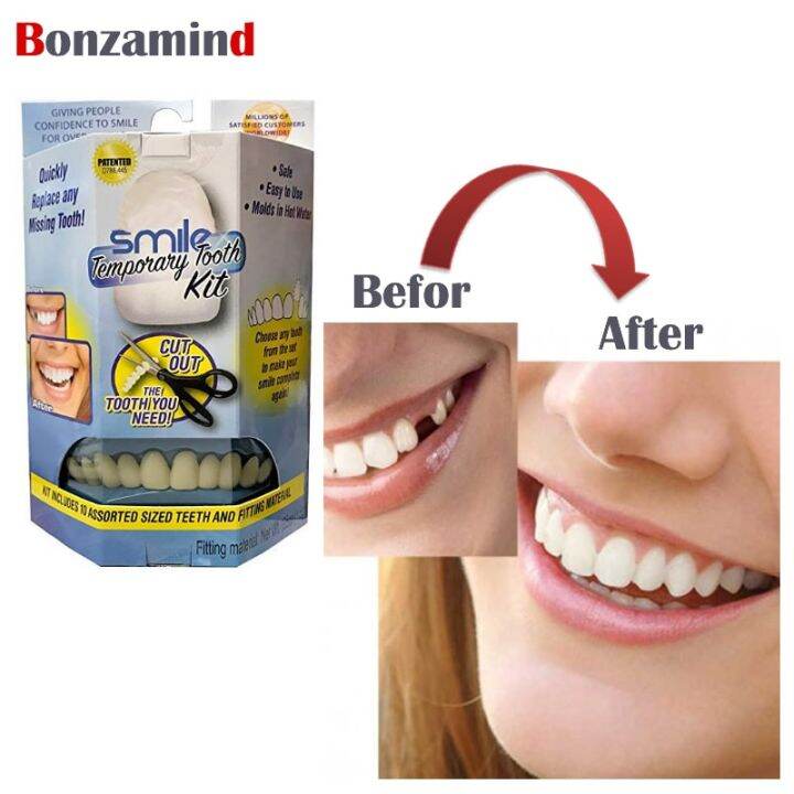 Gel veneers moderate perfect smile teeth veneers transparent teeth ...