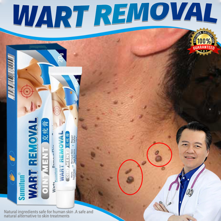 warts remover original watson removal ointment cream original skin tags ...