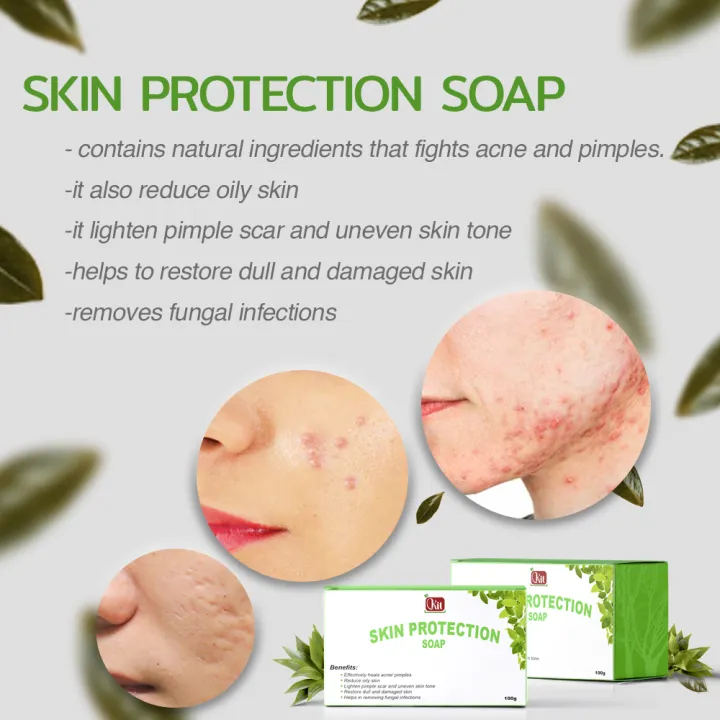 BUY 1 TAKE 2 HOT SALE! EFFECTIVE Soap for Oily skin, and Acne/ Pimple ...