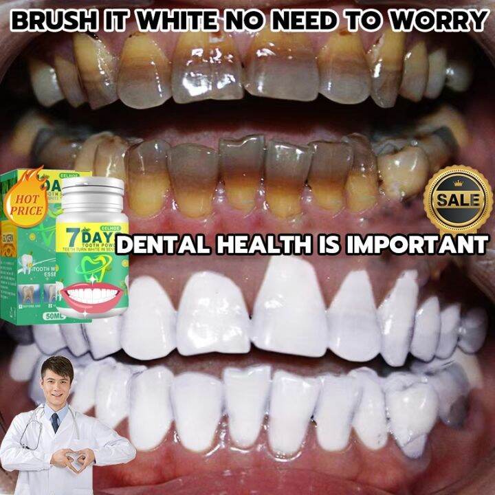 [COD] EELHOE Teeth Cleaning Mousse Tartar Remover Hygiene Remove Stains ...