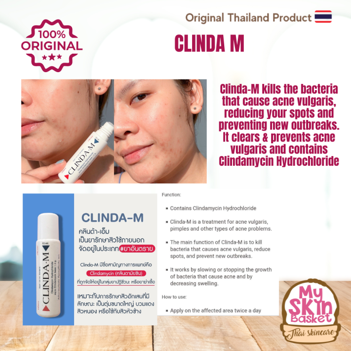 Clinda M Solution For Acne 15ml | Lazada PH