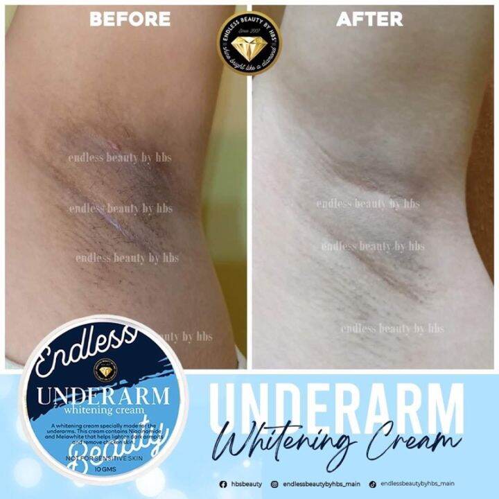 Underarm Whitening Cream (BEST SELLER) with Freebie gets rid of chicken ...