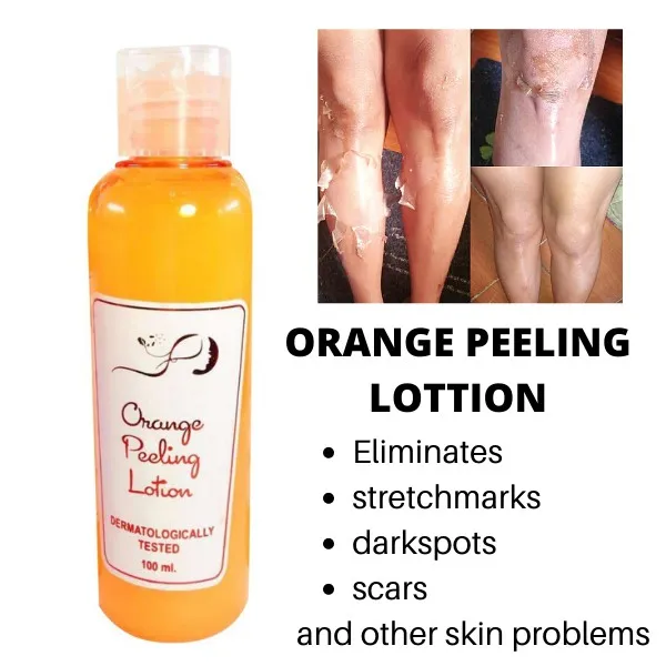SET OF 2 Original Orange Peeling Lotion INSTANT WHITENING IN JUST 5 ...
