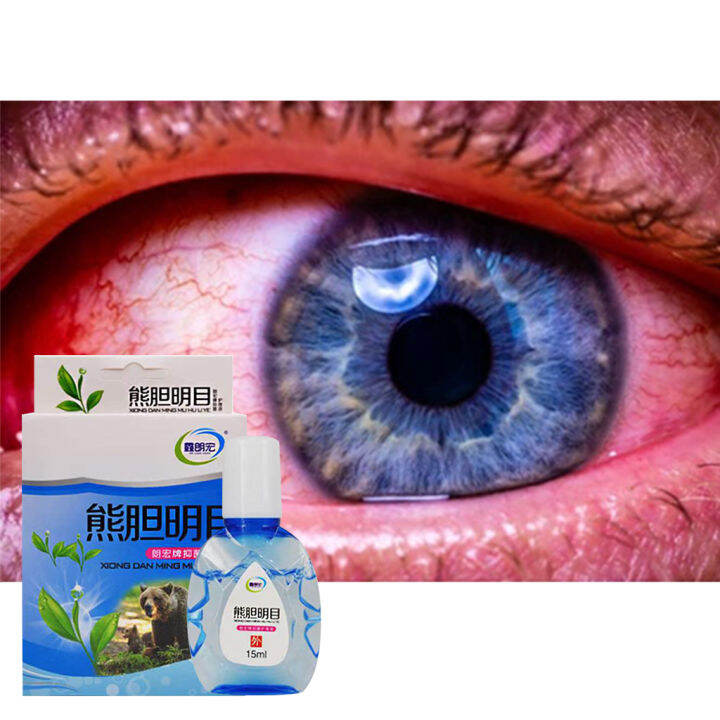 Eye Drops Blurred Vision Cataract Treatment Itchy Relax Fatigue Eyes ...