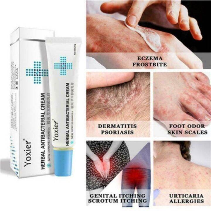 BEST SALE!!!!!﹉ Yoxier Herbal Antibacterial Cream Psoriasis Cream Anti ...
